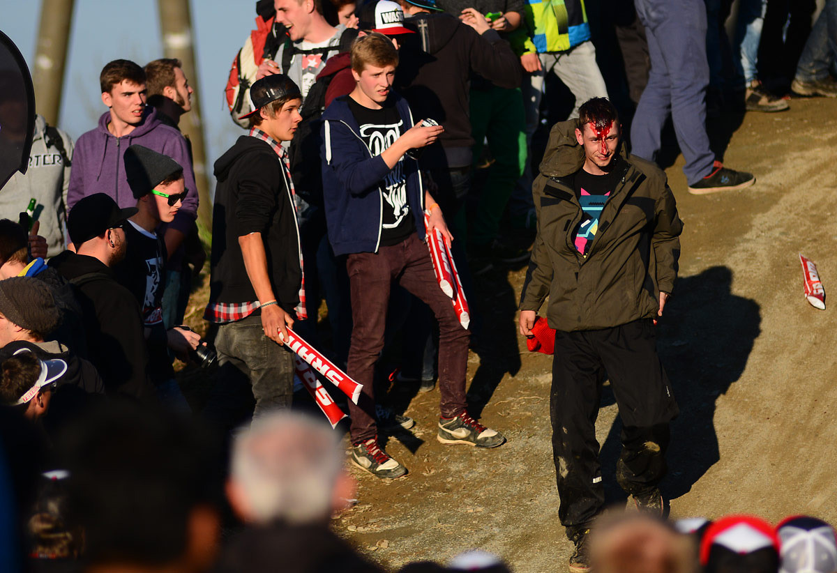 Bloody Redneck Who Got Landed on at the Dirtmasters Whip Off ...