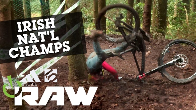 Vital MTB - Mountain Bikes, Reviews, Videos, Races